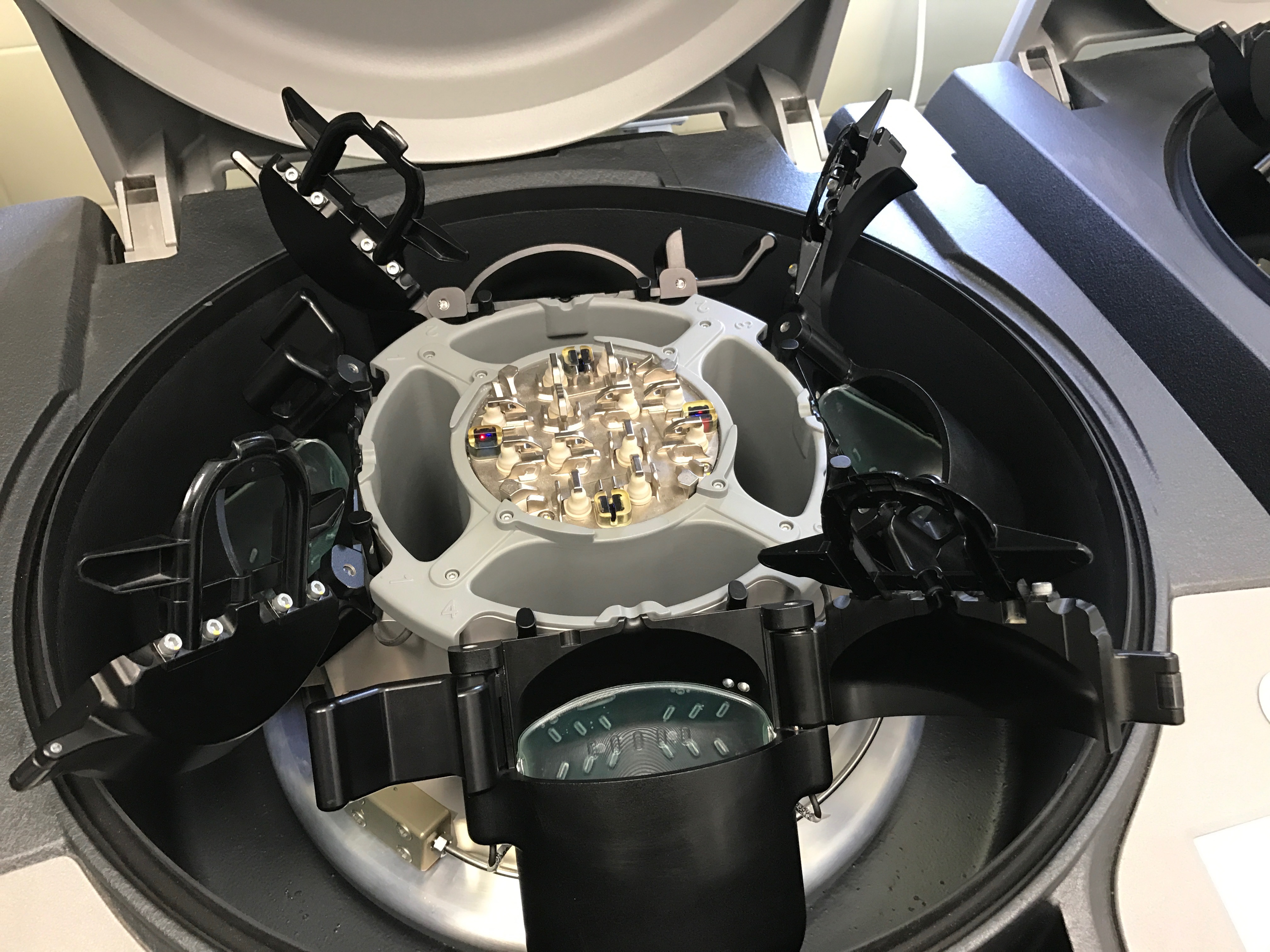 Reveos and Atreus Automated Blood Component Processing: My Experience ...