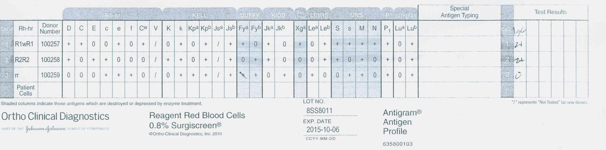 Case Study: Importance of Enzyme Panels in RBC Antibody Workups – Dr ...