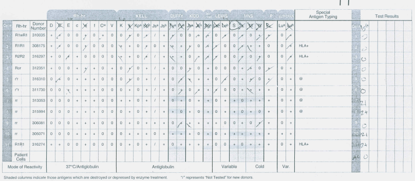 Case Study: Importance of Enzyme Panels in RBC Antibody Workups – Dr ...