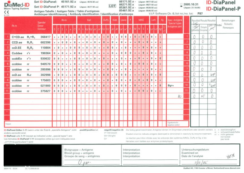 Anti-Jka only reacting with polyspecific reagents – Dr. Zeyd Merenkov