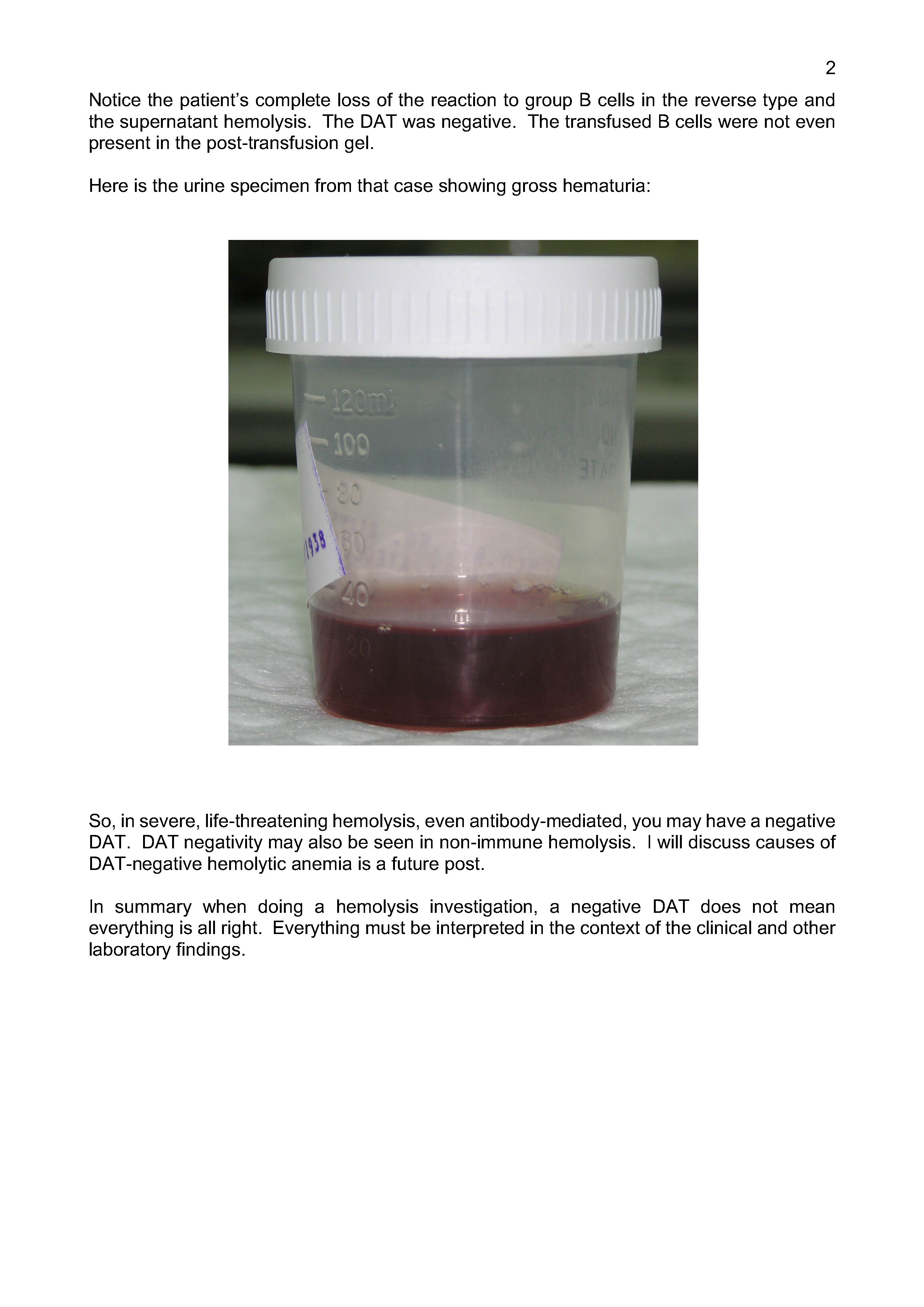 Clinical Significance of a Negative DAT – Dr. Zeyd Merenkov