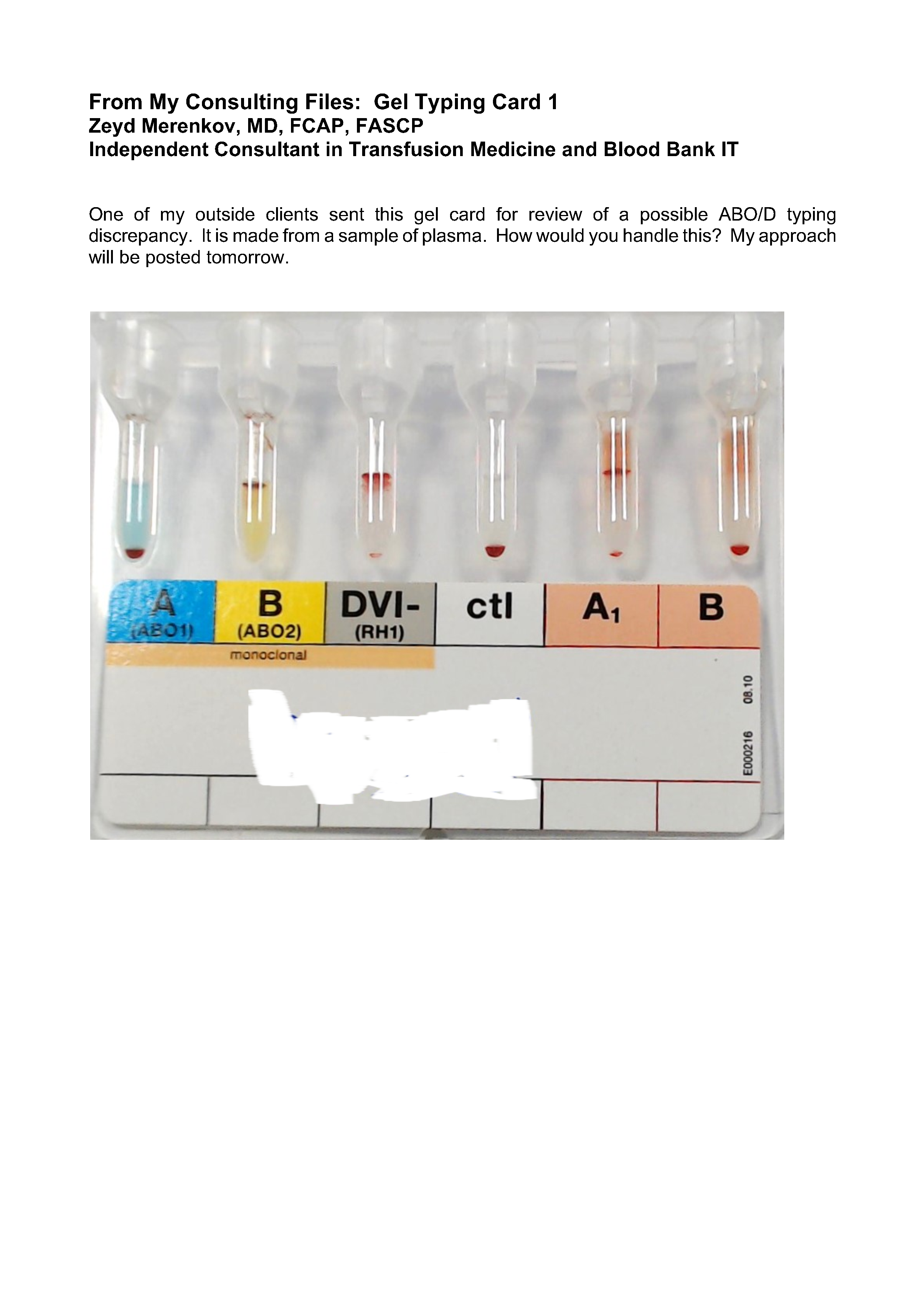 From My Consulting Files: Gel Card – Dr. Zeyd Merenkov