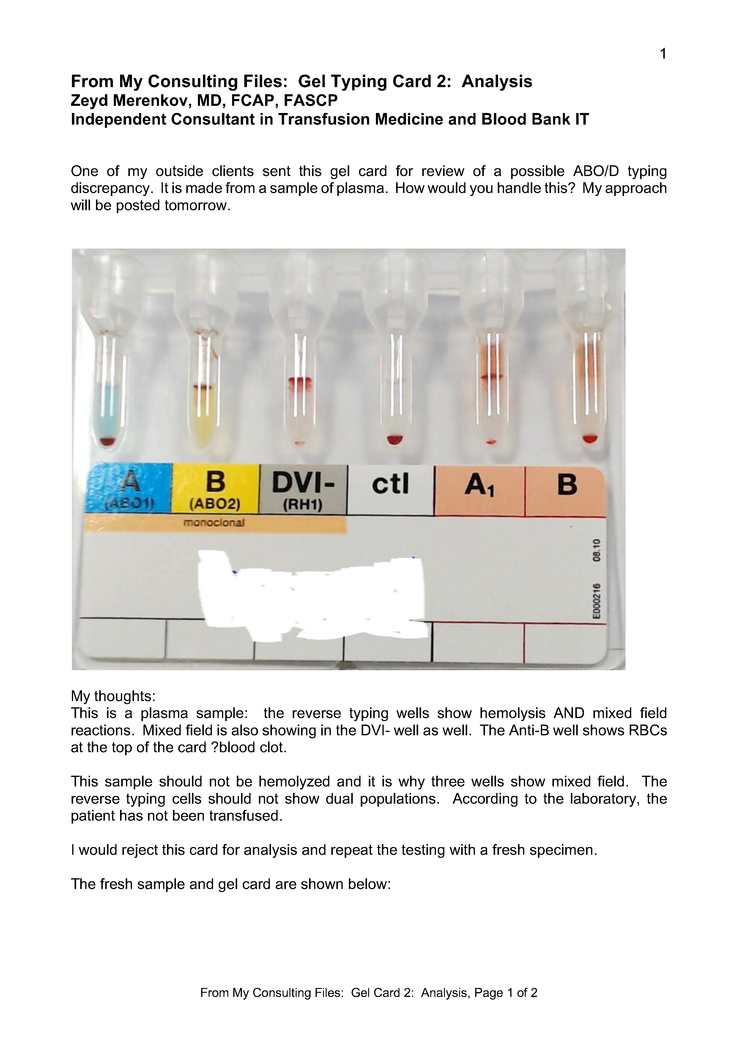 From My Consulting Files: Gel Typing Card 2 Analysis – Dr. Zeyd Merenkov