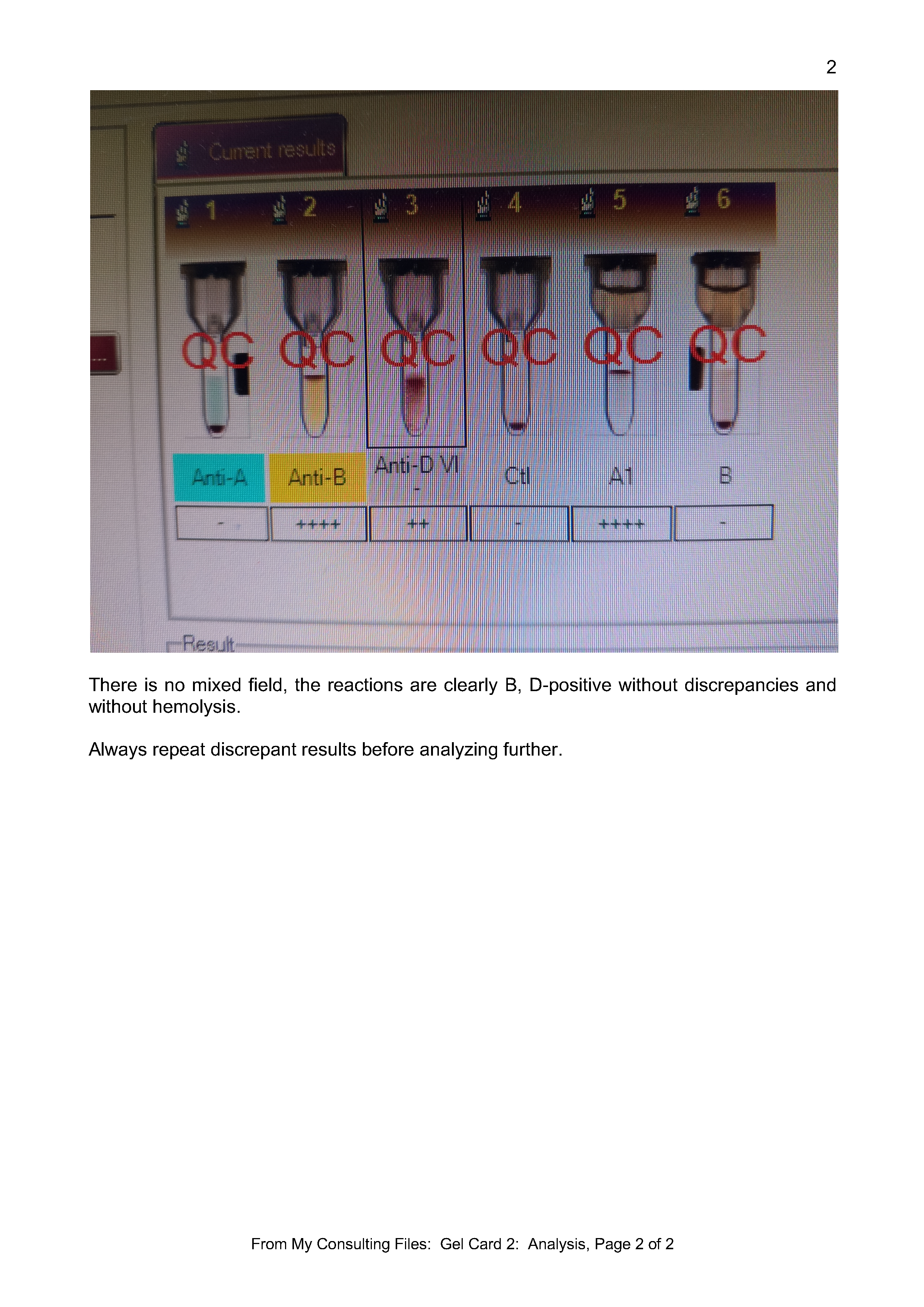 From My Consulting Files: Gel Typing Card 2 Analysis – Dr. Zeyd Merenkov