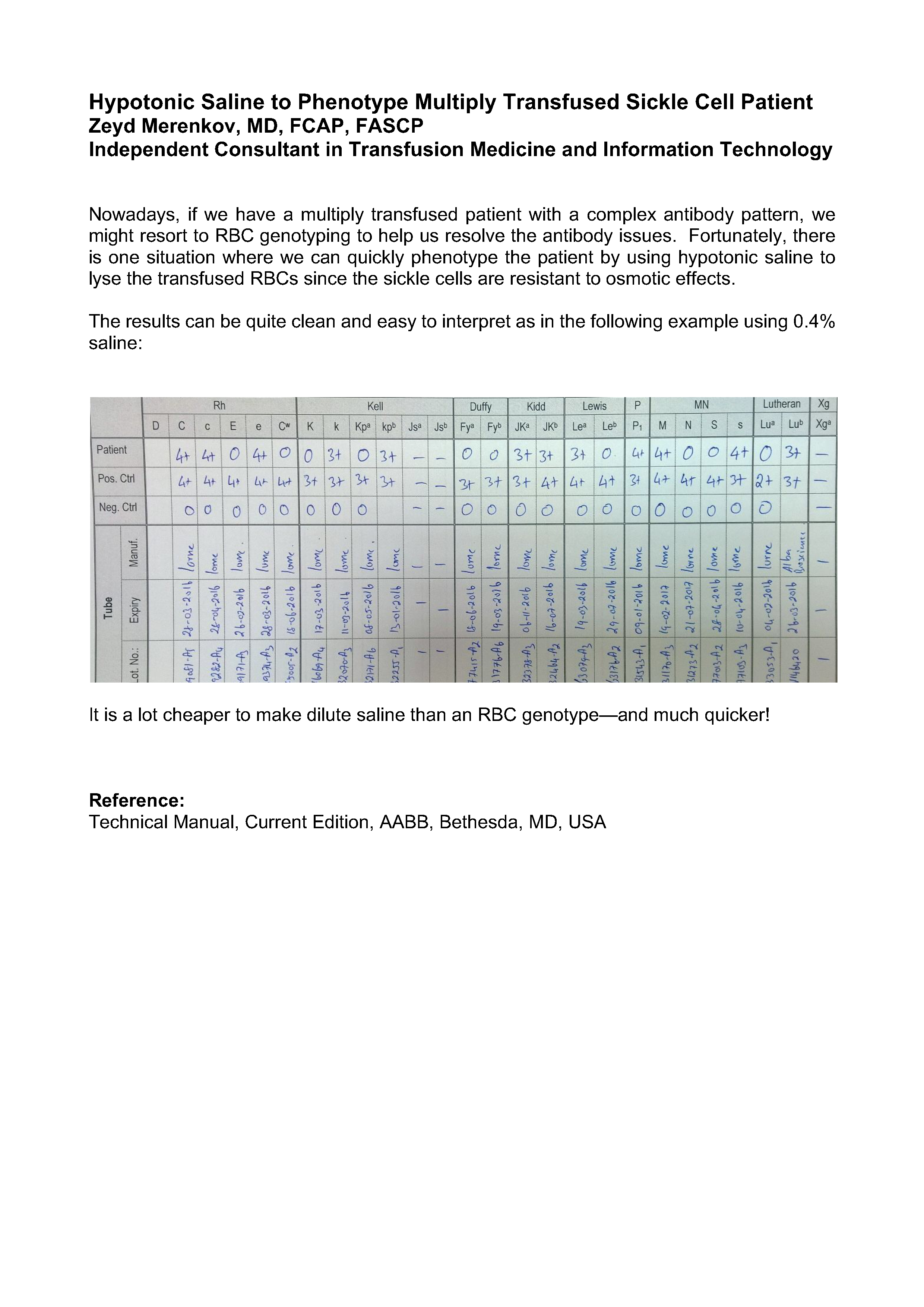 Hypotonic Saline in Sickle-Cell Disease Patient Testing – Dr. Zeyd Merenkov